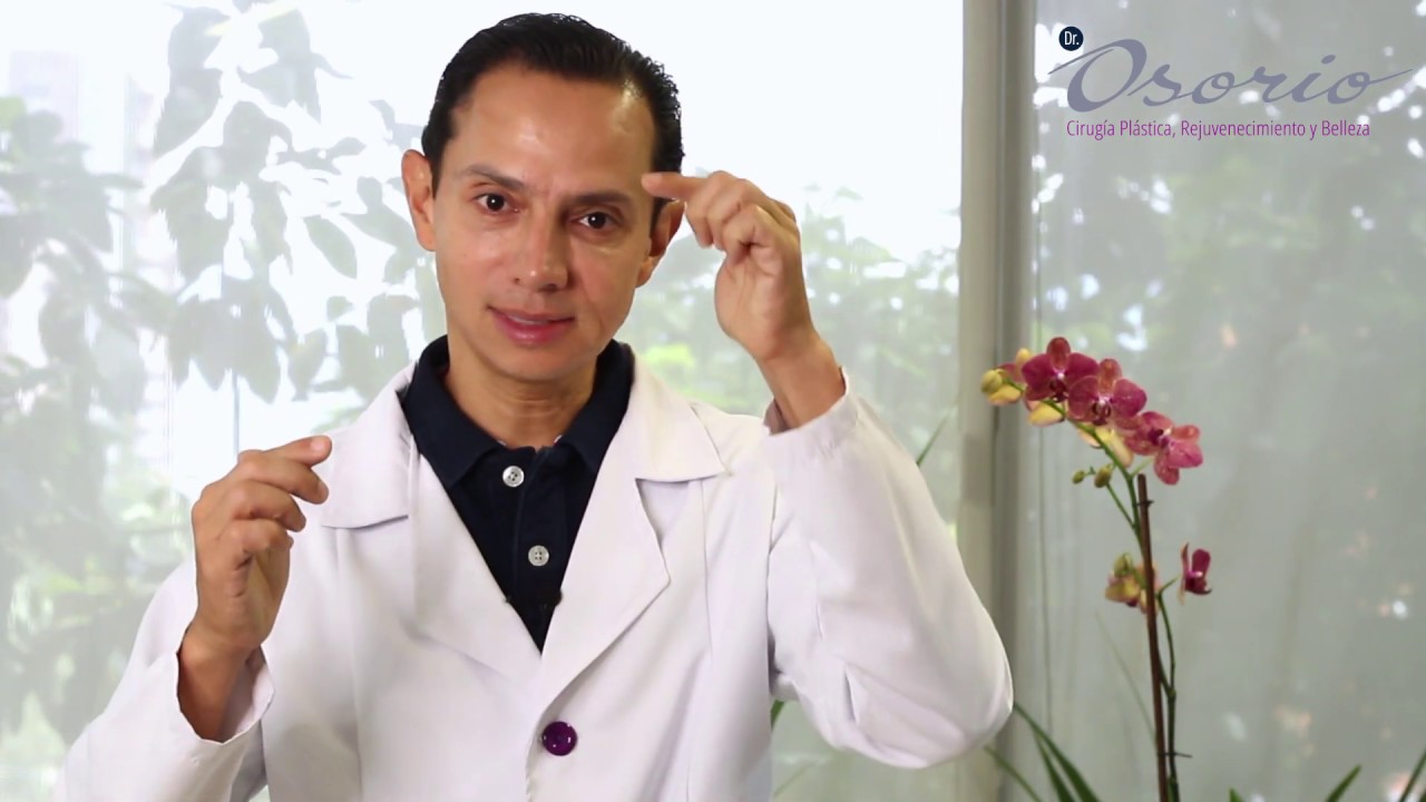 ¿Qué es el callo óseo en la rinoplastia?. - YouTube