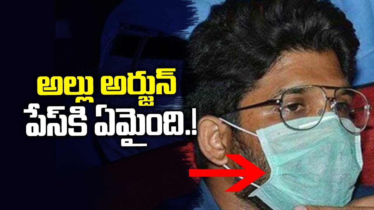 What Happened To allu arjun face | #alluarjun | Why allu arjun weared ...