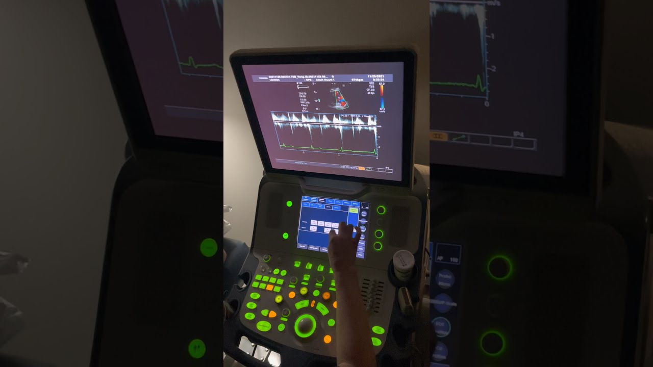 Adult Echo Protocol - YouTube