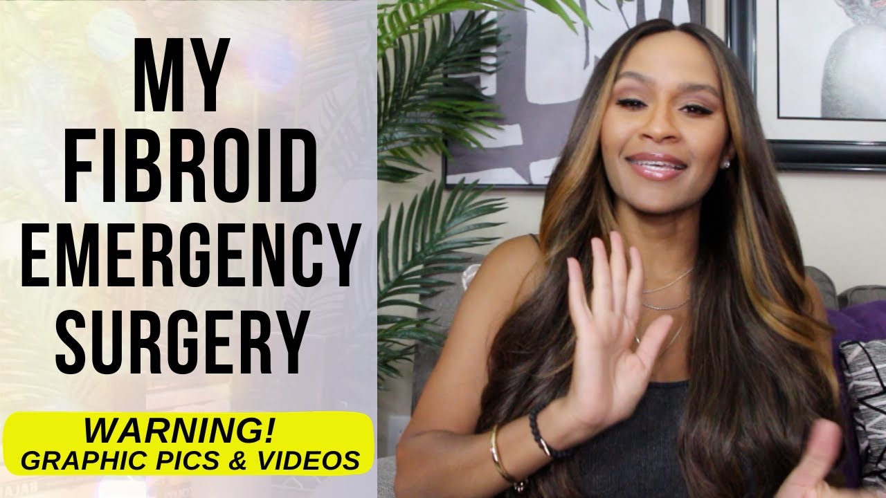 My Fibroid Emergency Surgery with severe Anemia Story | Open Myomectomy ...