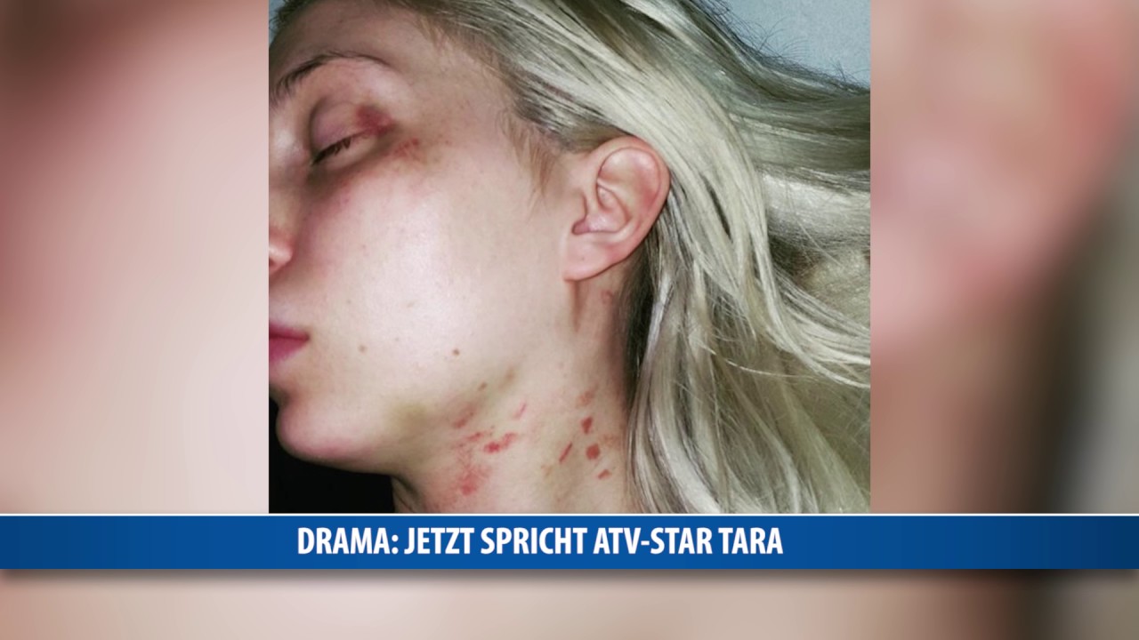 Drama: Jetzt spricht ATV-Star Tara - YouTube