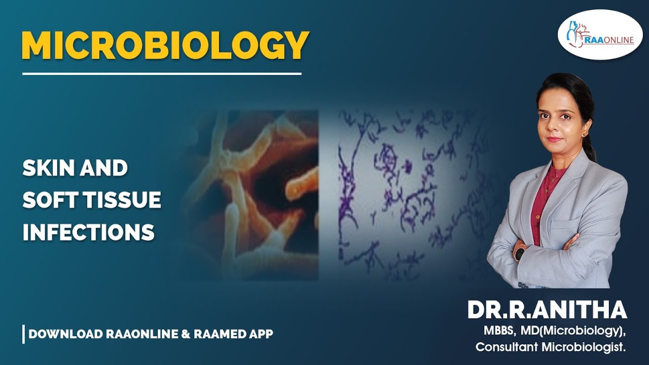 Microbiology | Skin and Soft tissue infections | Raaonline - YouTube