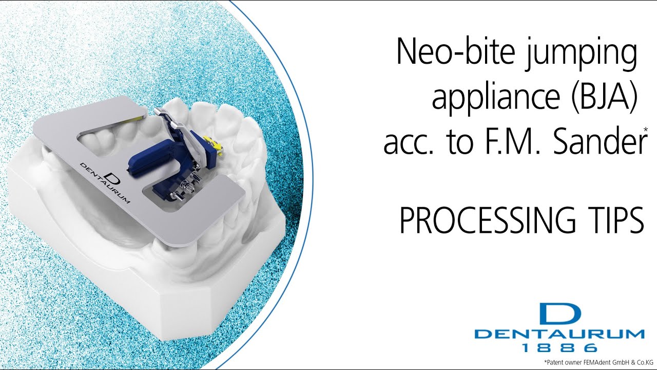 Neo-bite jumping appliance (BJA) acc. to F.M. Sander – production and ...