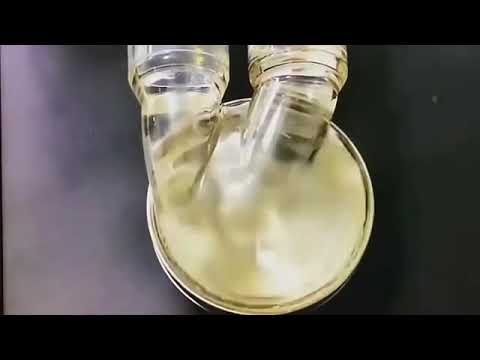 EXCOR ACTIVE BERLIN HEART - Pediatric VAD #perfusionist #VAD # ...