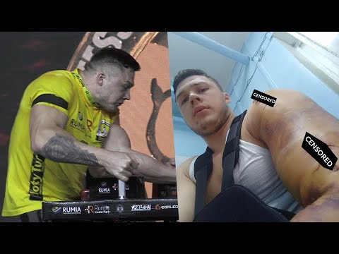 My story, how I broke my arm in armwrestling! Как я сломал руку в армрестлинге!