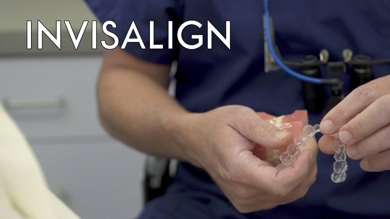 Smart Track Invisalign decreases treatment time - YouTube