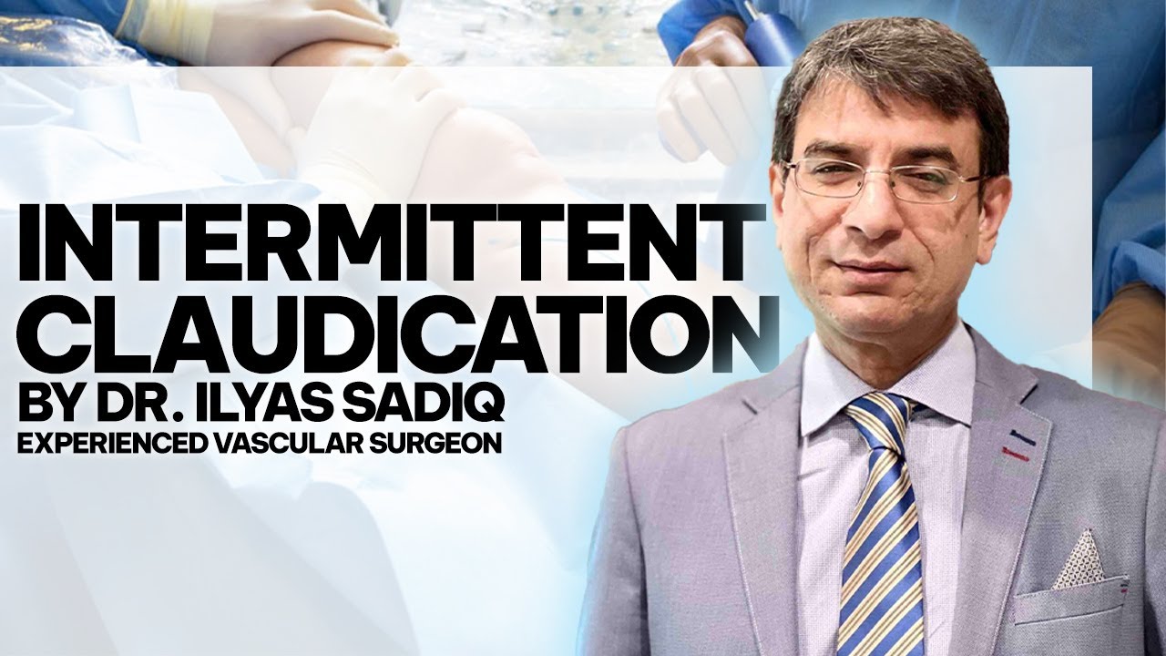 Causes, Treatment & Prevention Of Intermittent Claudication By Dr ...