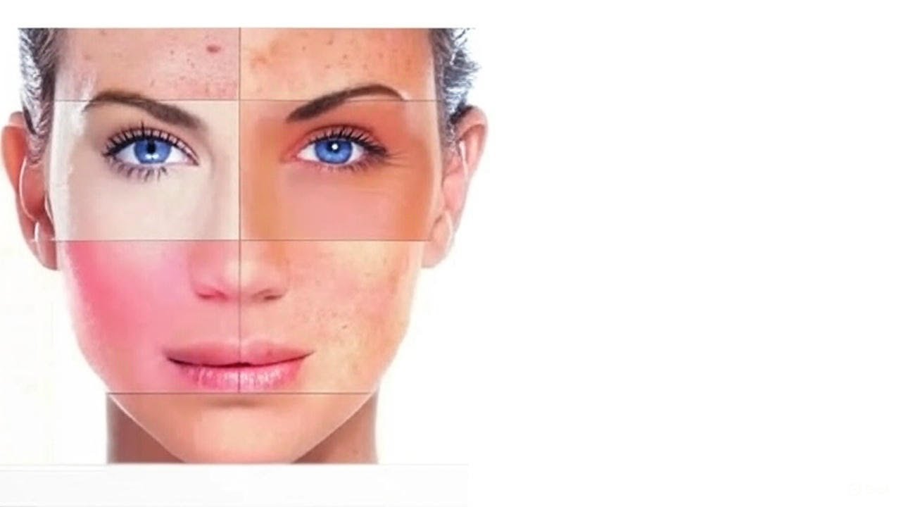 Vitamin Deficiency: 7 Symptoms That Can Be Seen on Your Face - YouTube