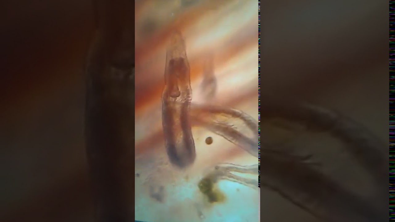 DANGEROUS FISH PARASITES:DACTYLOGYROSIS|GILL FLUKE|ROHU FISH|LABEO ...