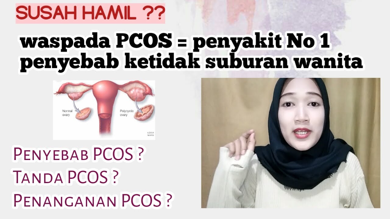 PCOS PENYEBAB KEMANDULAN | APA PENYEBAB TANDA DAN PENGOBATANNYA? - YouTube
