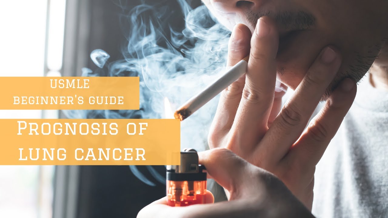 Lung cancer - USMLE - YouTube
