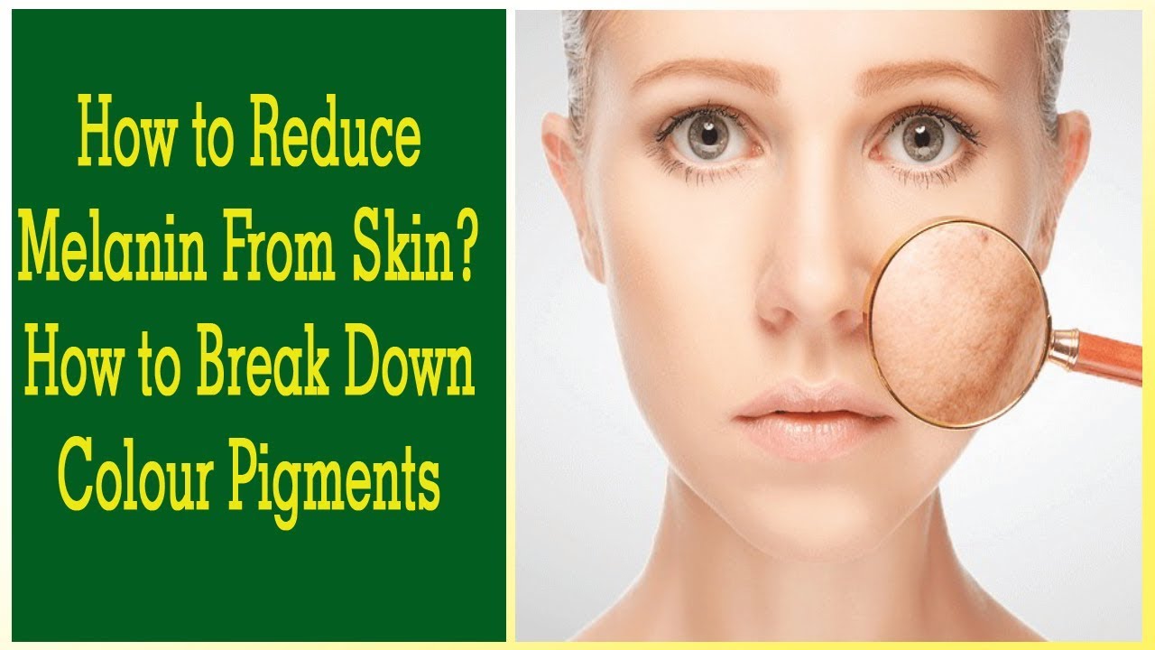 How You Can Reduce Melanin in The Skin | The Esthetic Clinics, India - YouTube