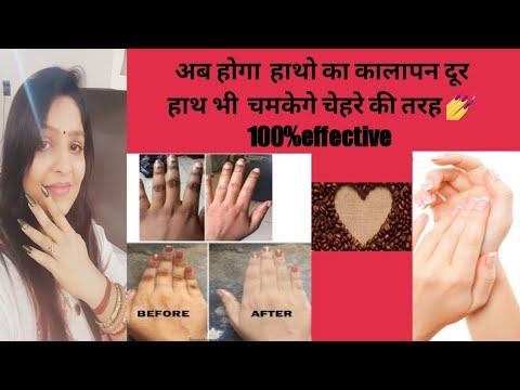 hand tanning and blackness removing remedies at home 100% effective ...
