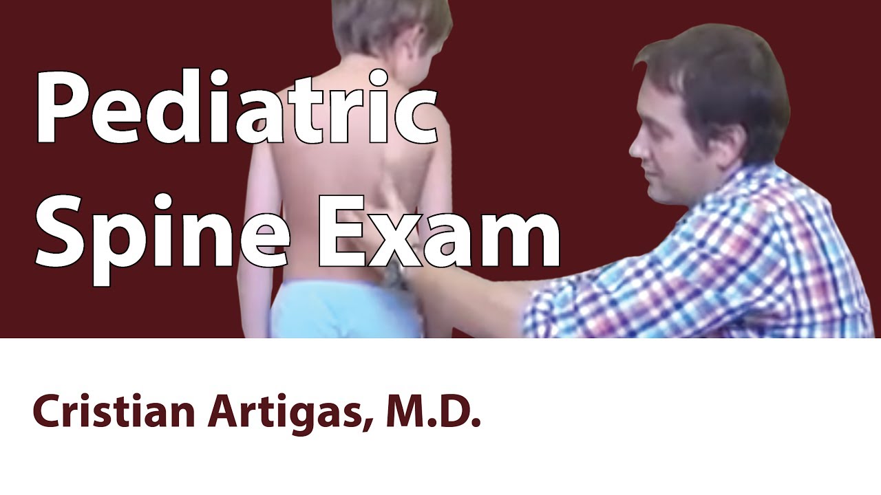 Pediatric Spine Exam - YouTube