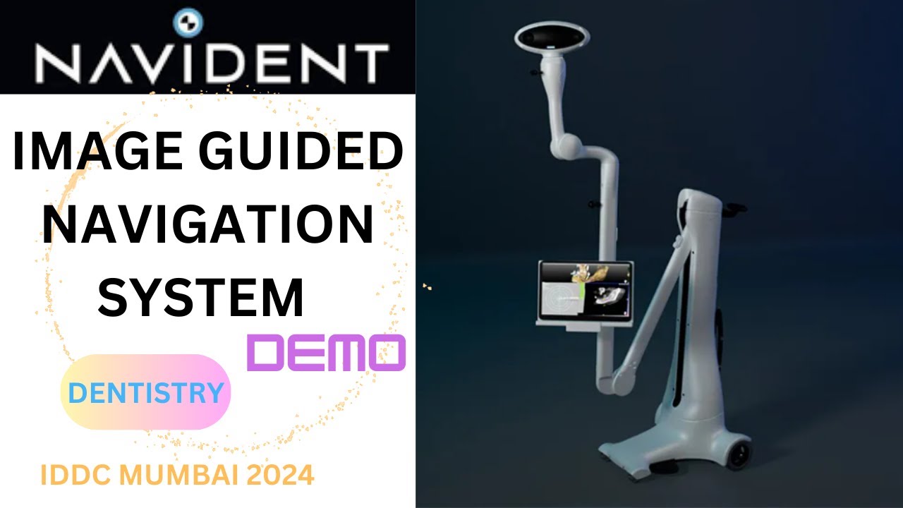 A DEMO OF NAVIDENT IMAGE GUIDED NAVIGATION SYSTEM FOR DENTISTRY. - YouTube