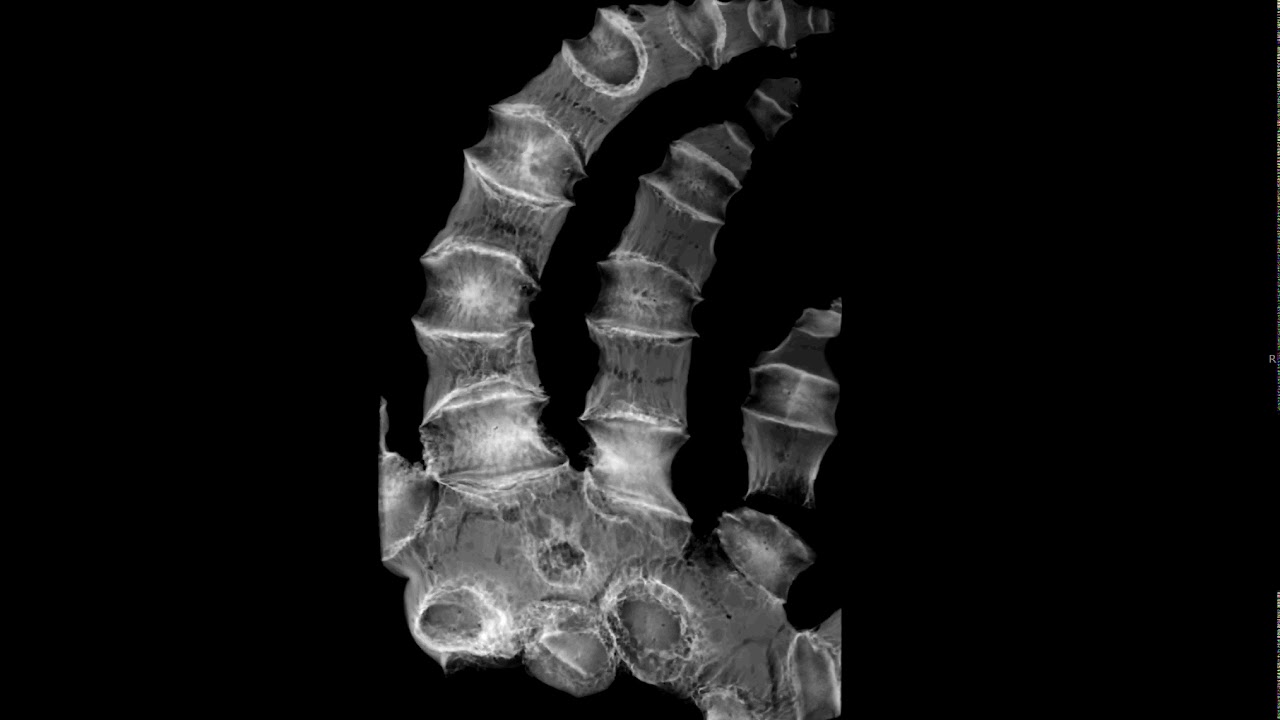CT scan of a fin of a killer whale - YouTube
