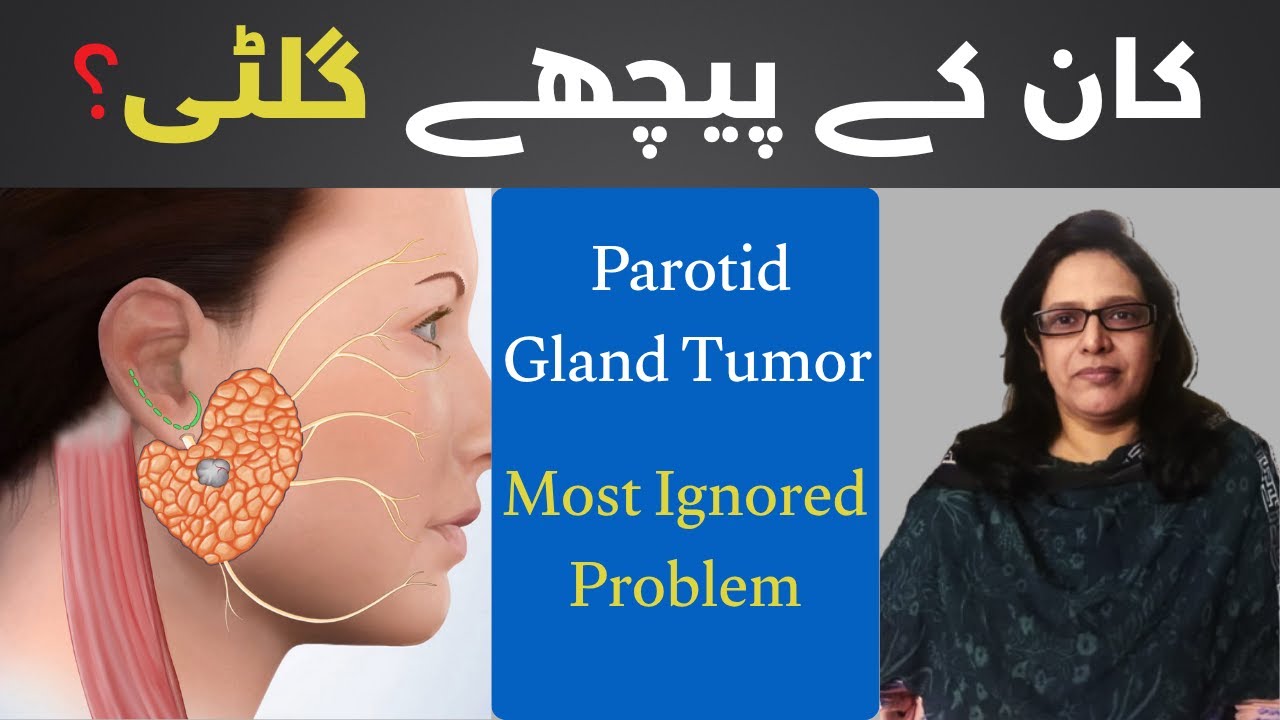 Parotid Gland Tumor Explained by Prof Dr Amna Javed - YouTube