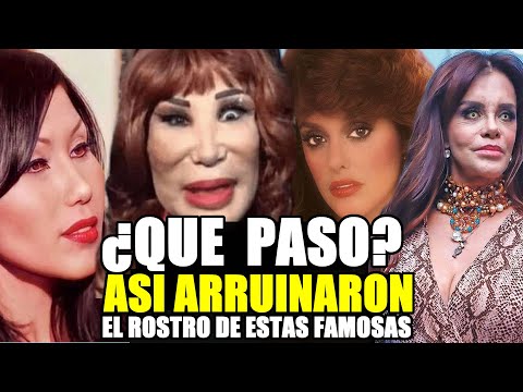 DE LYN MAY A LUCIA MENDEZ!  ASI ENGAÑARON A ESTAS ACTRICES Y CAMBIARON SU ROSTRO RADICALMENTE