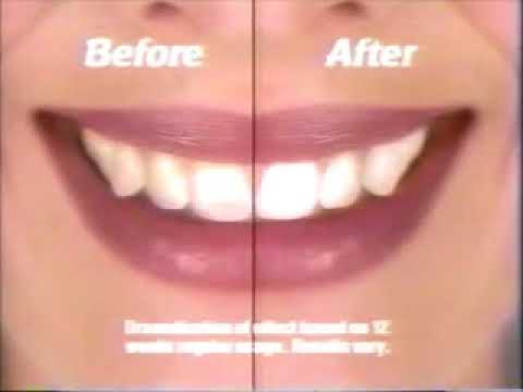 aquafresh whitening 1999