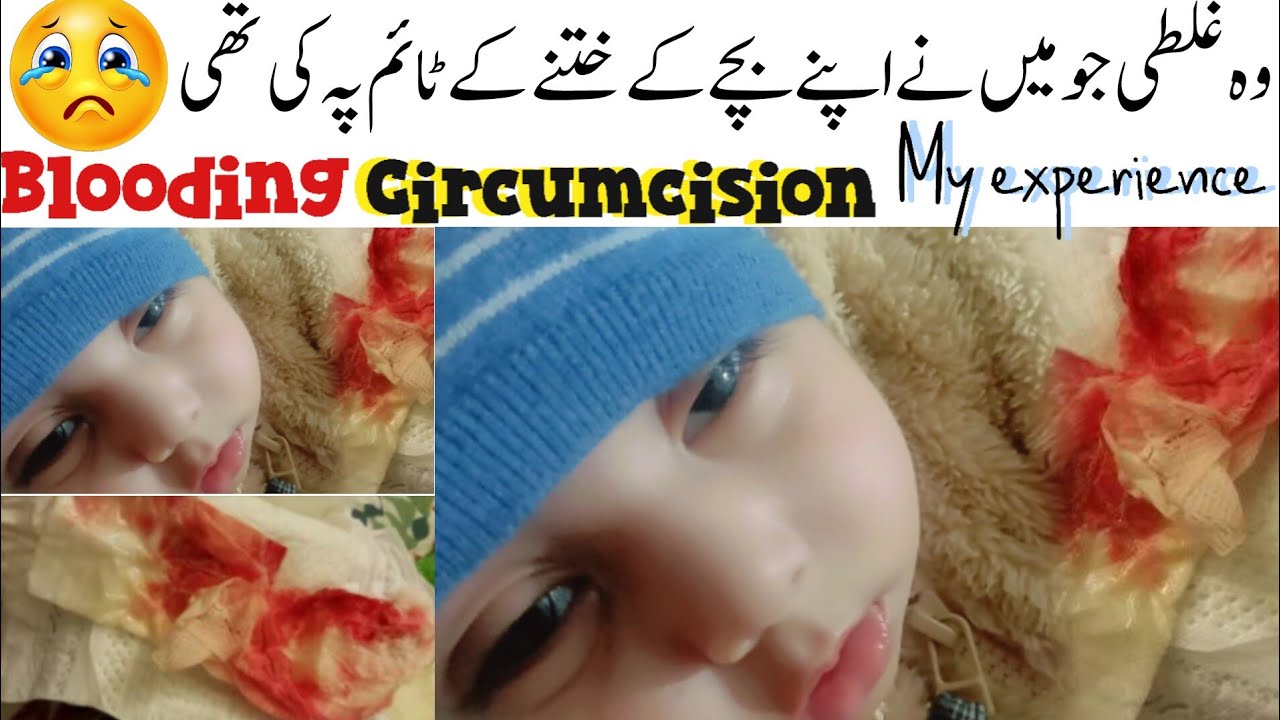 My Baby Circumcision Time My Experience😭 | Mera Bachay Ke Khatna Baby ...
