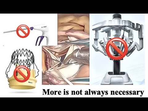 Totally Endoscopic AVR Without Robot, Cor-Knot, or Sutureless valve ...