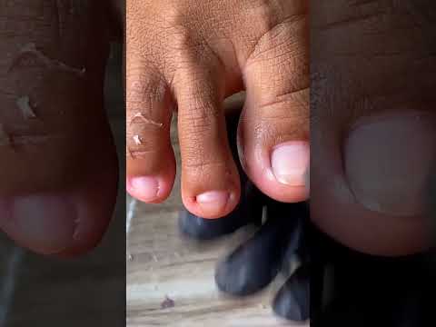 NAIL PEDICURE 💅 FULL VIDEO || SUPER SATISFYING TO WATCH 😱