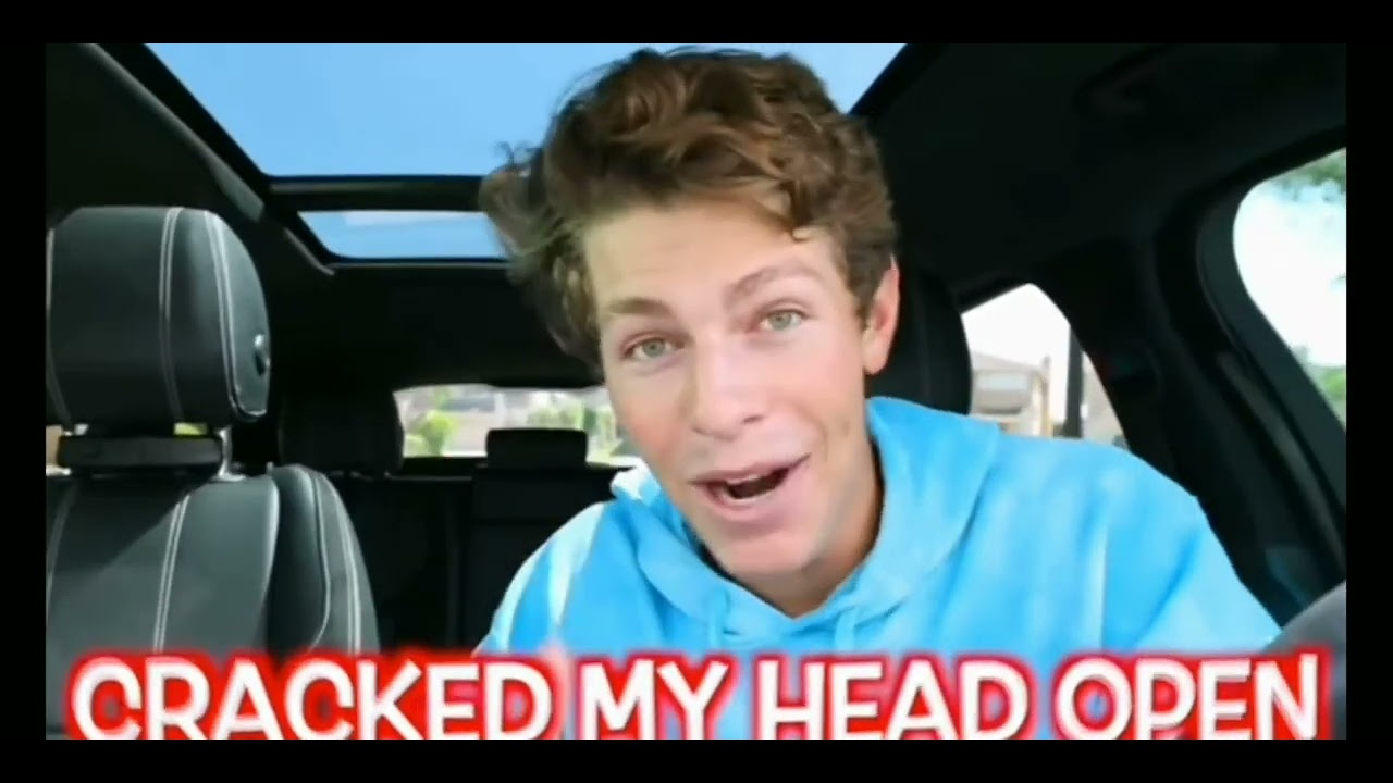 Ben azalart cracked his head open for real!!!??!?!! - YouTube