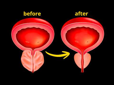 🔥Büyümüş prostatı küçültmek için günde 1 bardak için.