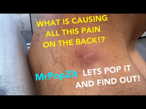 Mr. PopZit – MrPopZit Store