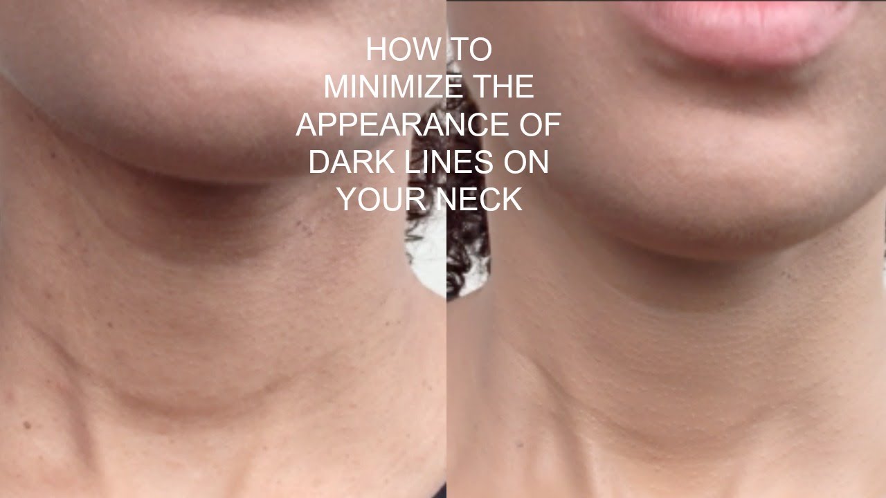 How To Conceal Dark Lines On Your Neck YouTube how-to-conceal-dark-lines-on-your-neck-youtube