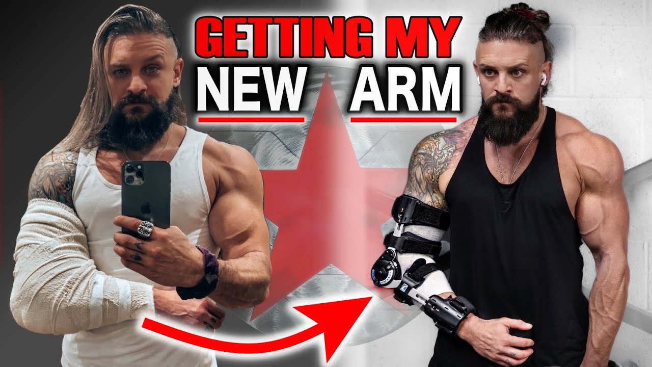From SURGERY to WINTER SOLDIER | First Look At My Scars & New Arm ...