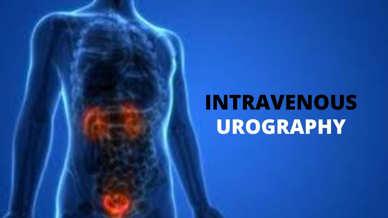 intravenous urography - YouTube