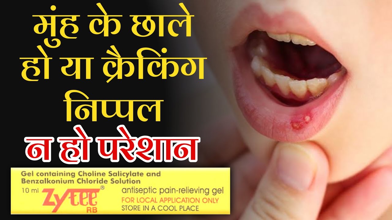 Zytee | Zytee rb | Zytee gel | Zytee gel how to use | Zytee gel use in ...