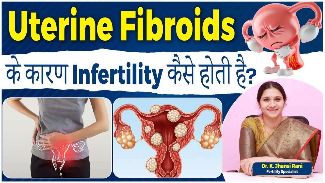 Can Fibroids Cause Infertility? 🤰 | Women’s Health Expert Advice ...