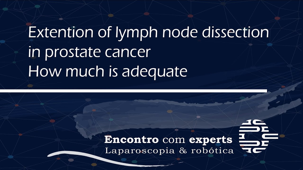 Extention of lymph node dissection in prostate cancer - How much is ...