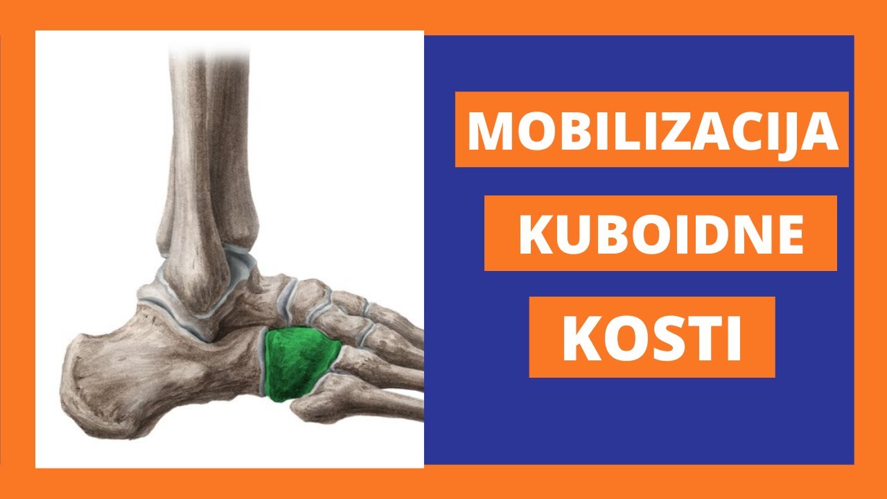 Bol VANJSKE strane STOPALA (kuboidni sindrom) - YouTube