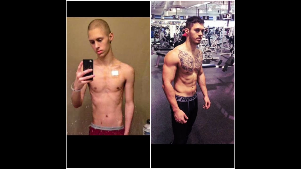 Skyler Miller: My Cancer Transformation - YouTube