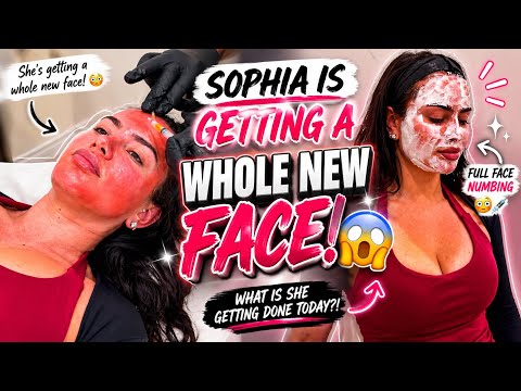 SOPHIA’S EXTREME FACE TRANSFORMATION!!!💔😳
