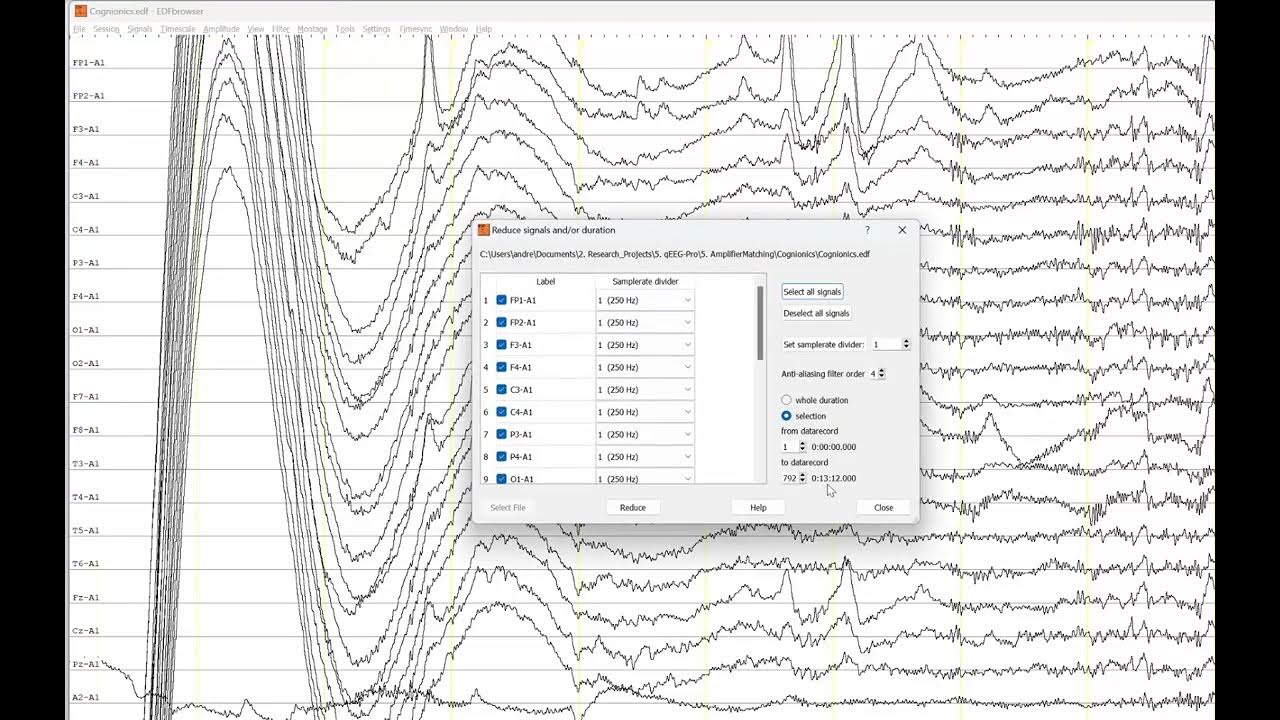 How To Reduce EDF File Size - YouTube