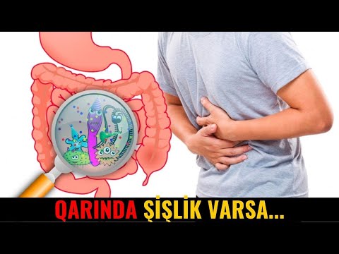 SİBO Xəstəliyi Nədir? Əlamətləri bunlardır!