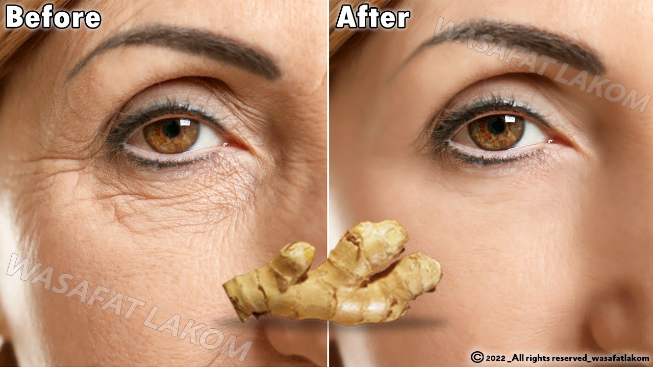 Even if you are 70 years old,🌿put it on wrinkles, it will make your ...