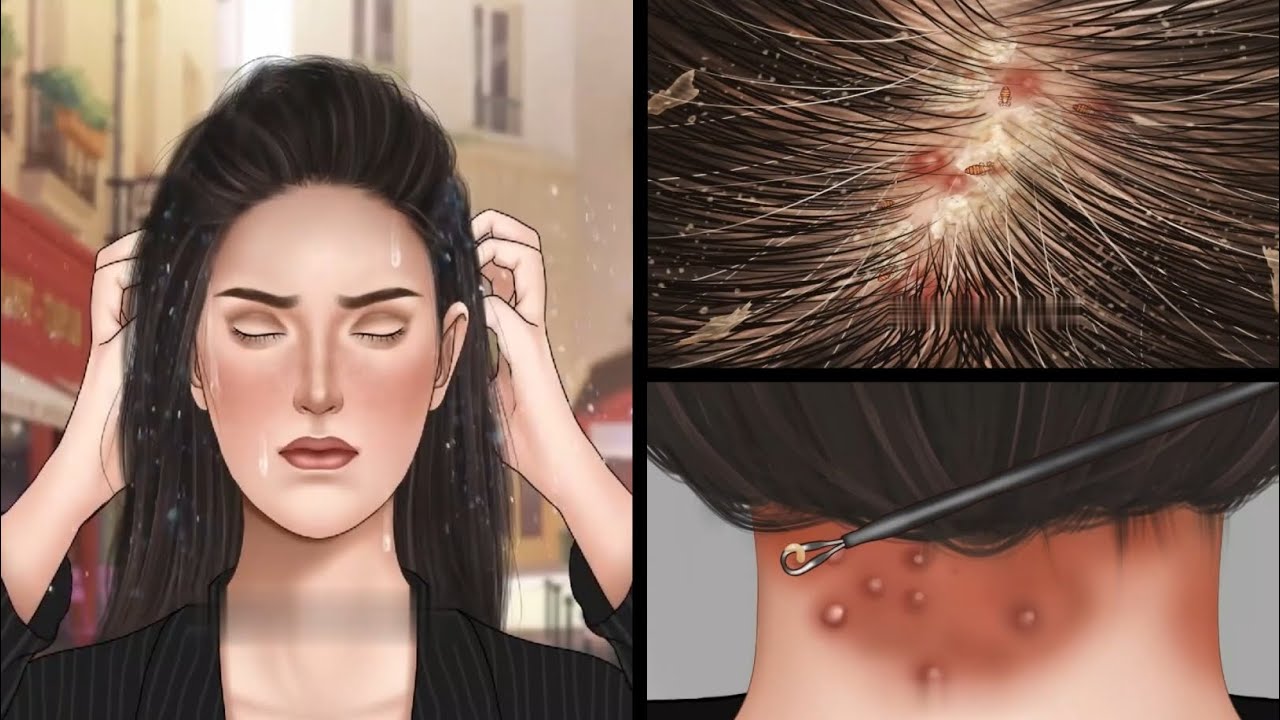 ASMR Hair Treatment Animation | Asmr Acne Removal Skin Care Animation ...