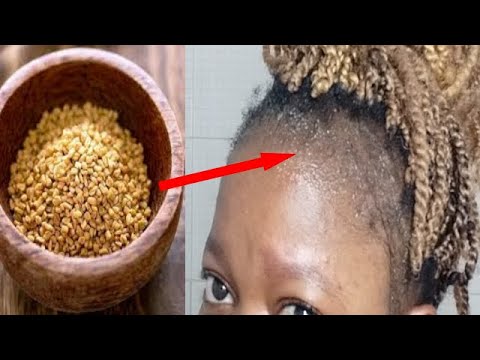 HOW I USE FENUGREEK SEED FOR 14 DAYS TO GROW MY BALD HAIR - YouTube