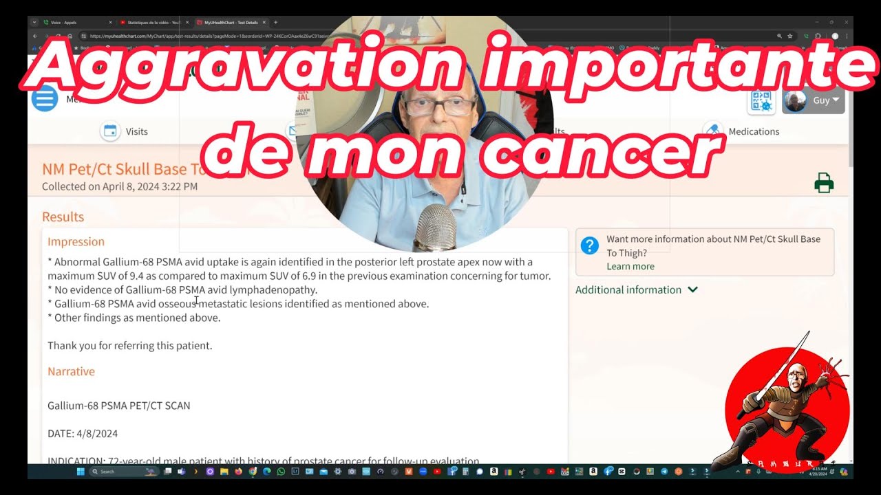 Aggravation de mon cancer: métastases, croissance tumorale et marqueurs ...
