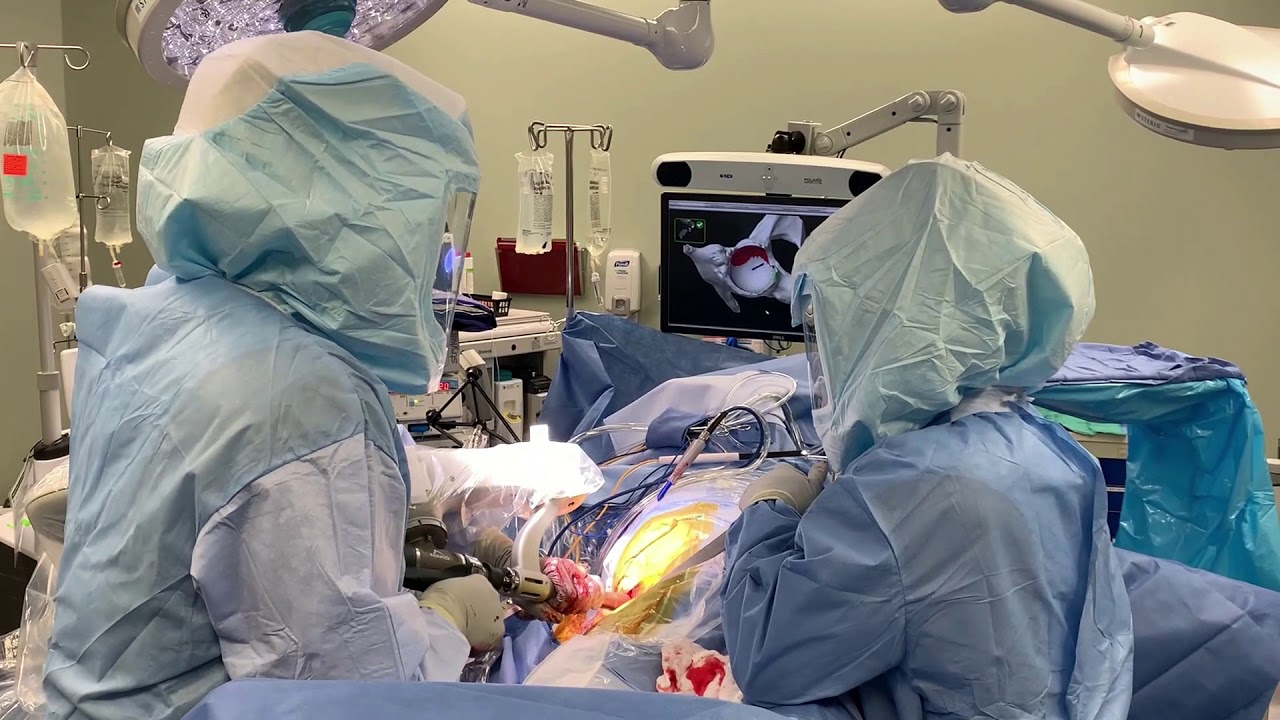 THA - Direct Anterior Approach MAKOplasty - YouTube