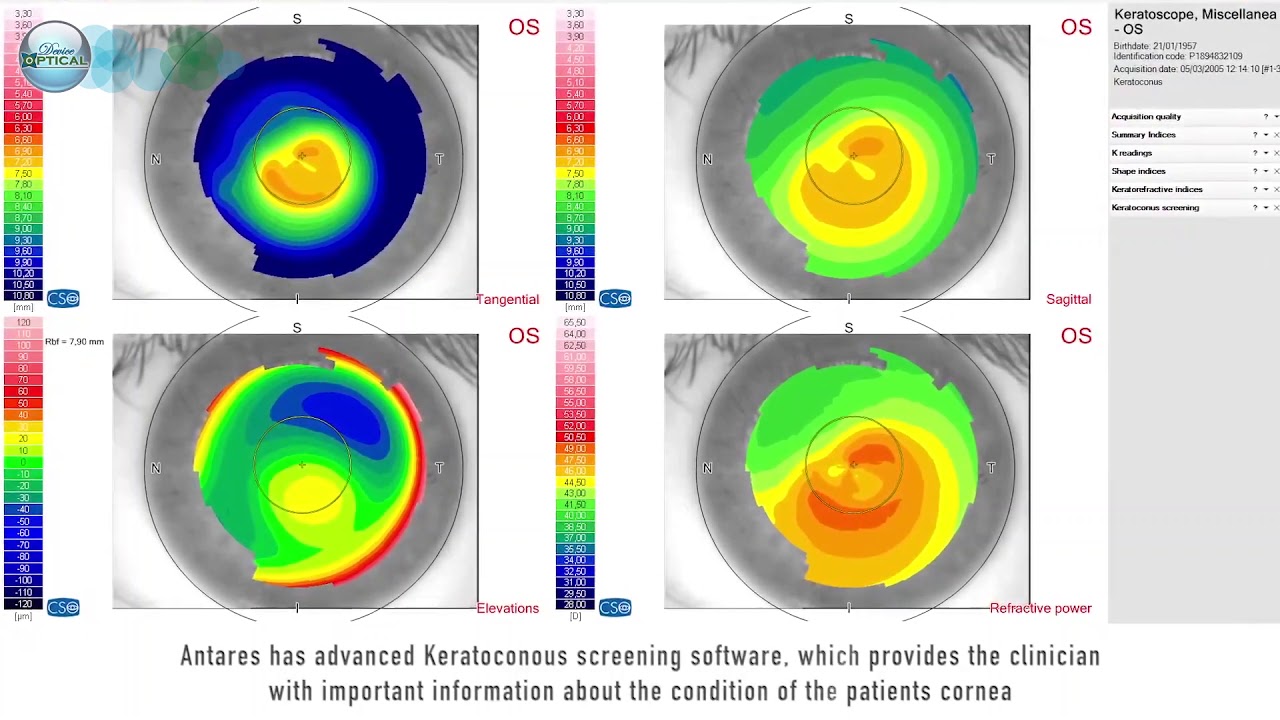 CSO Antares Topographer SPANISH - YouTube