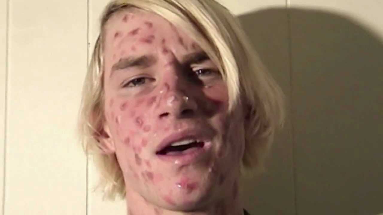 The Fruitarian Diet Results - YouTube