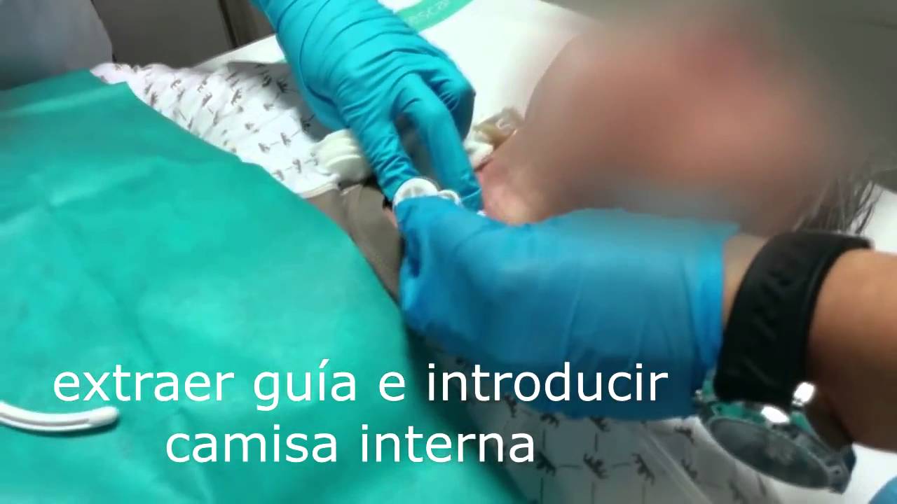 Vídeo Del Procedimiento De Traqueotomía