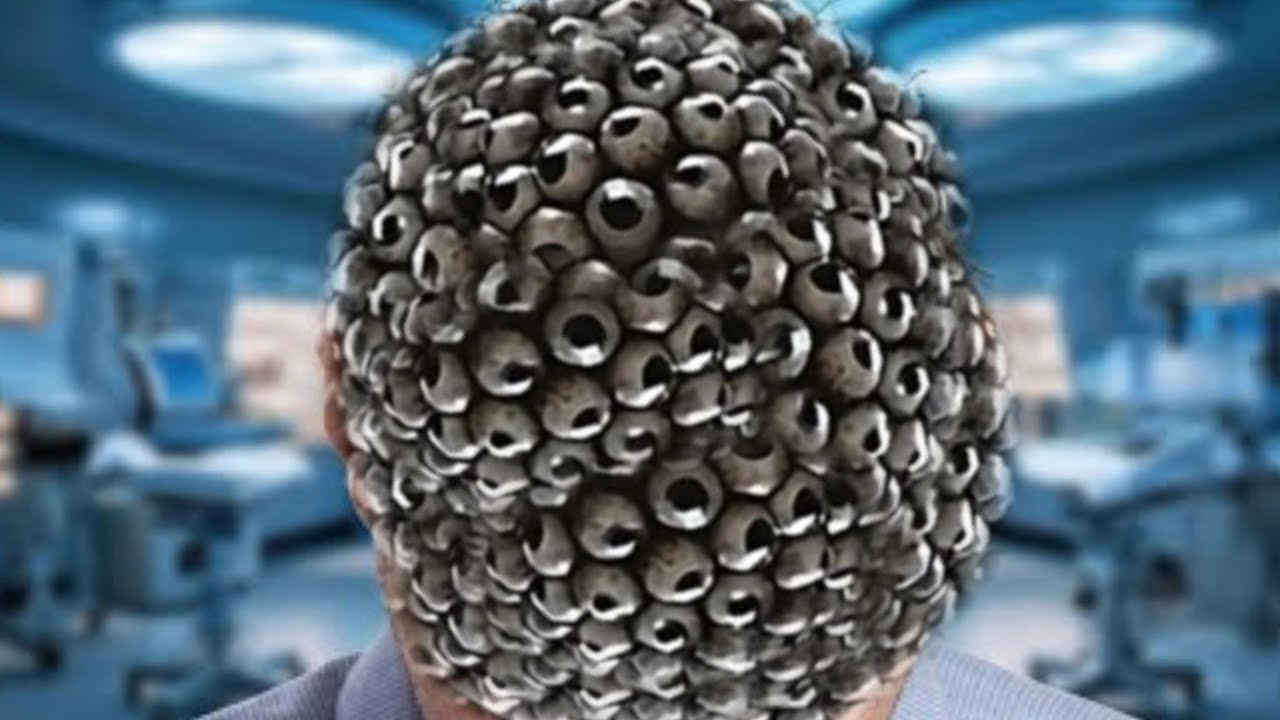 ASMR Trypophobia Remove And Dog Ticks Infected Head | deep cleaning ...