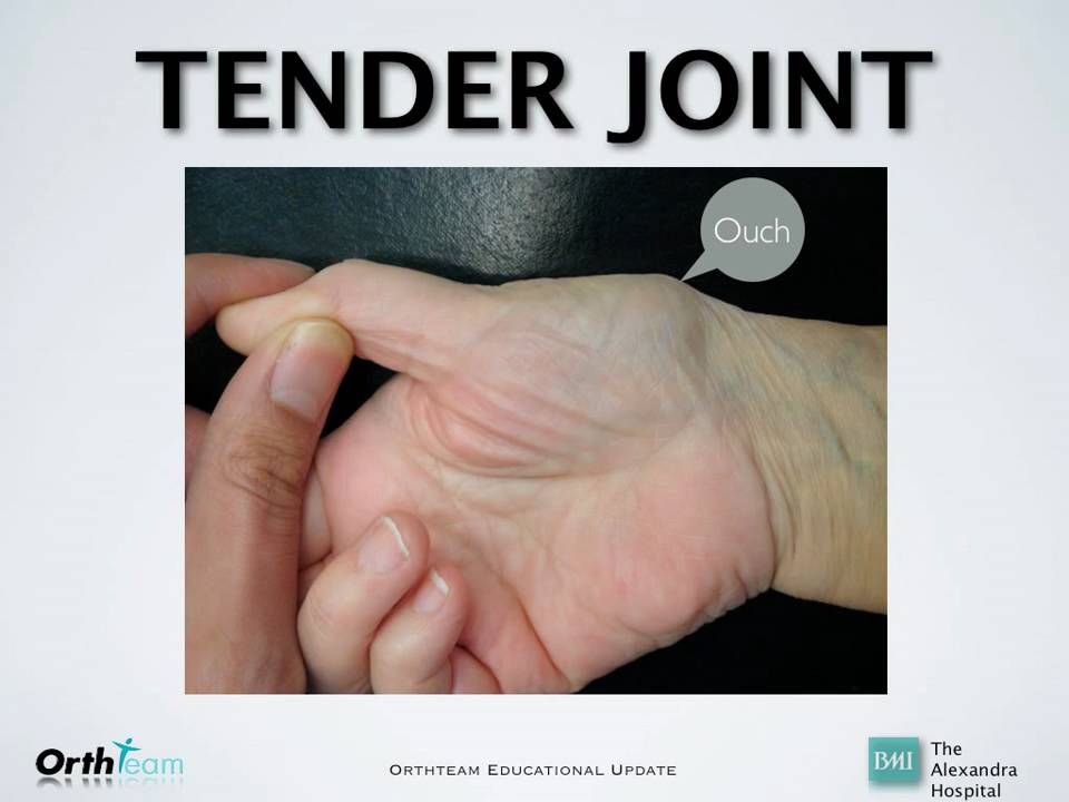 MJH Final Stiff Thumb Voice mov YouTube mjh-final-stiff-thumb-voice-mov-youtube